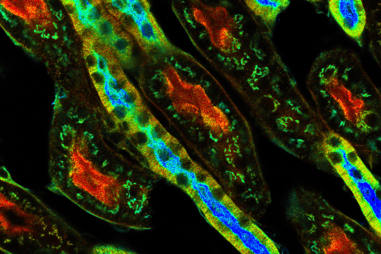 Fluorescence Lifetime Imaging | Aplicaciones | Leica Microsystems