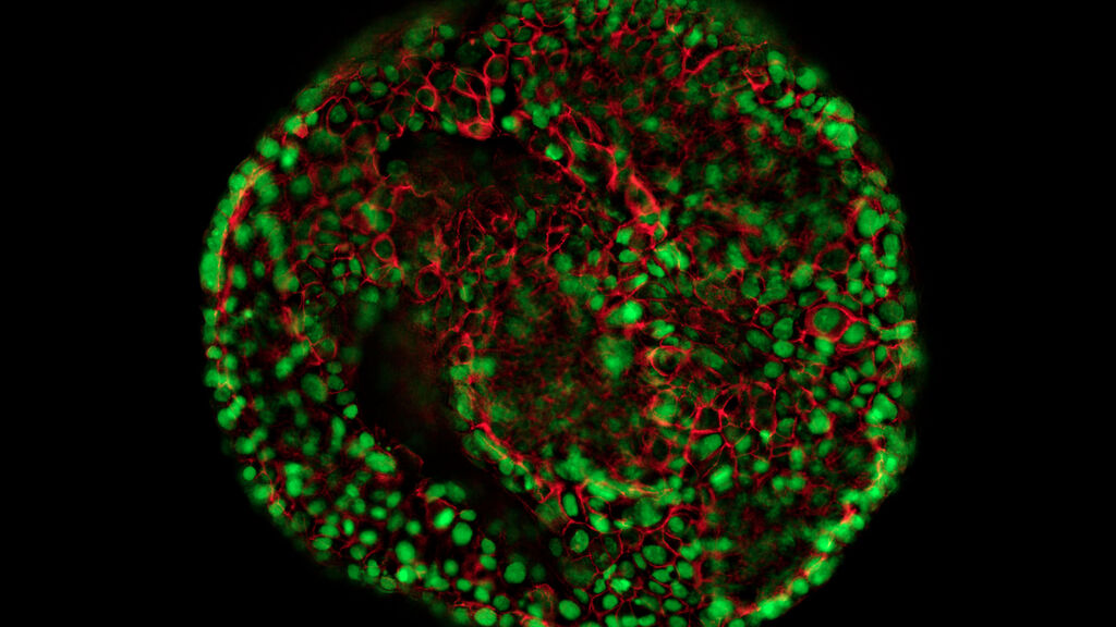 Microscope Imaging Software | Products | Leica Microsystems