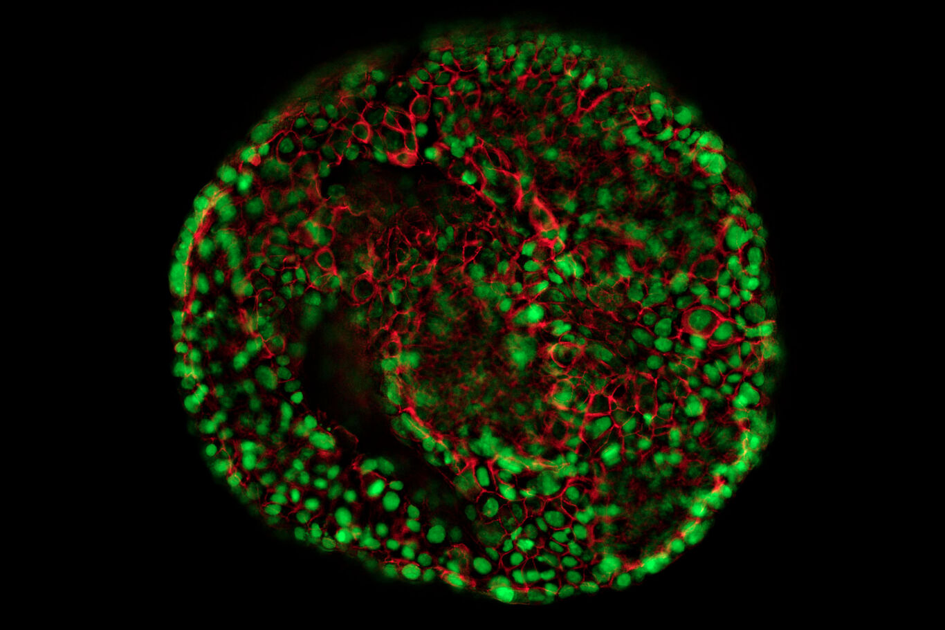 Organoids and 3D Cell Culture | Applications | Leica Microsystems