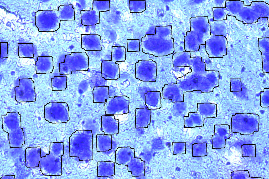 Leica LMD6 & LMD7 Laser Microdissection Microscopes | Products | Leica ...