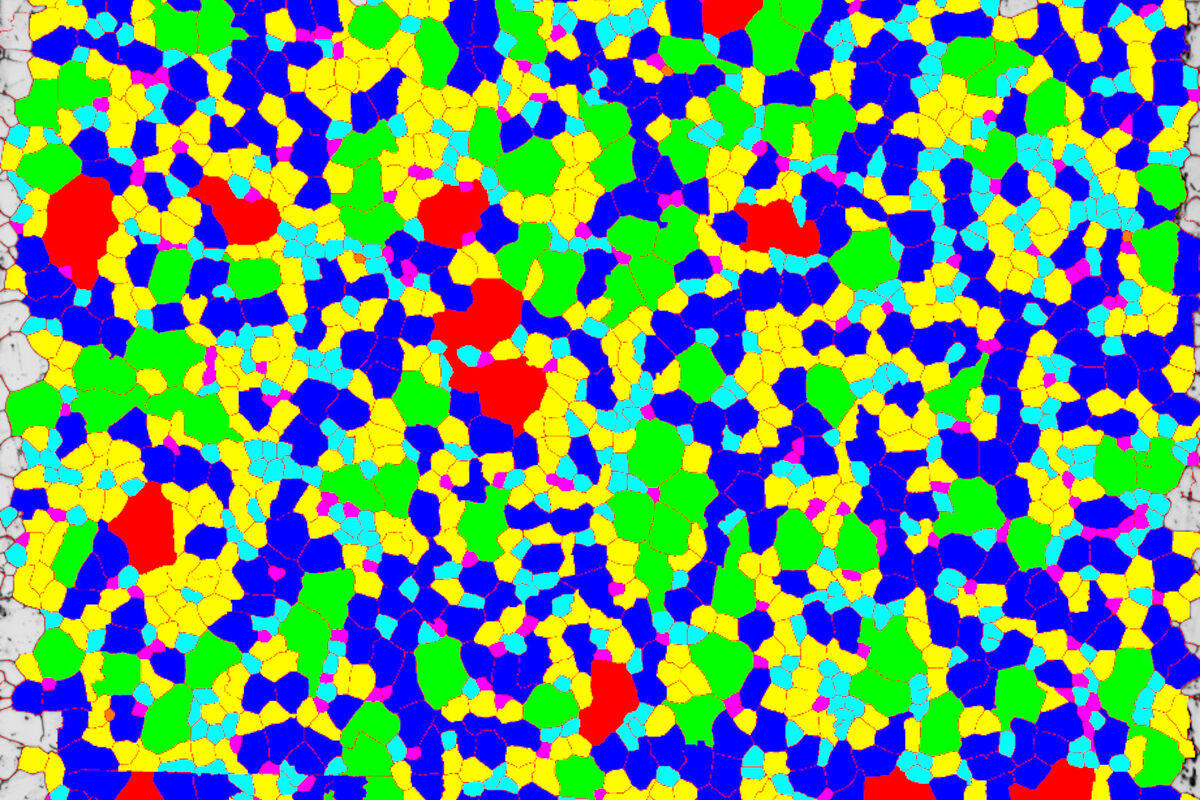 Inverted Microscopes for Grain Size Analysis: Three Factors to Consider | Learn & Share | Leica ...