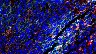 Aivia AI Image Analysis Software - Applications | Products | Leica ...