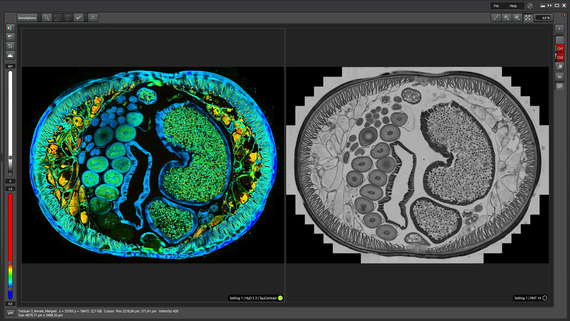LAS X Life Science ライフサイエンス画像解析用プラットフォーム LAS X ソフトウェア | 製品紹介 | Leica ...