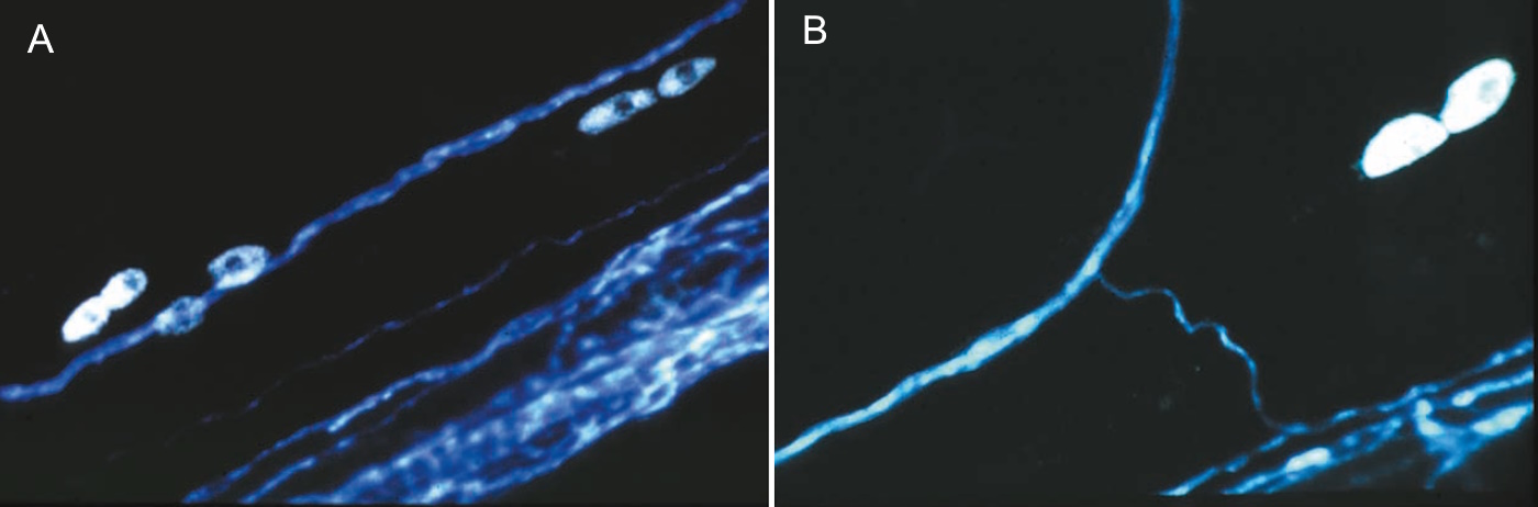 epifluorescence microscopy uses