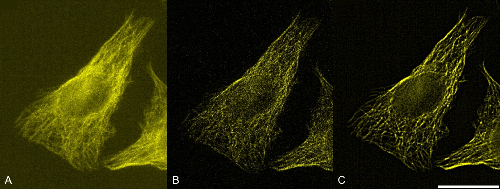 The Power of Pairing Adaptive Deconvolution with Computational Clearing | Learn & Share | Leica ...