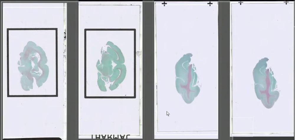 How to Streamline Your Histology Workflows | Learn & Share | Leica ...