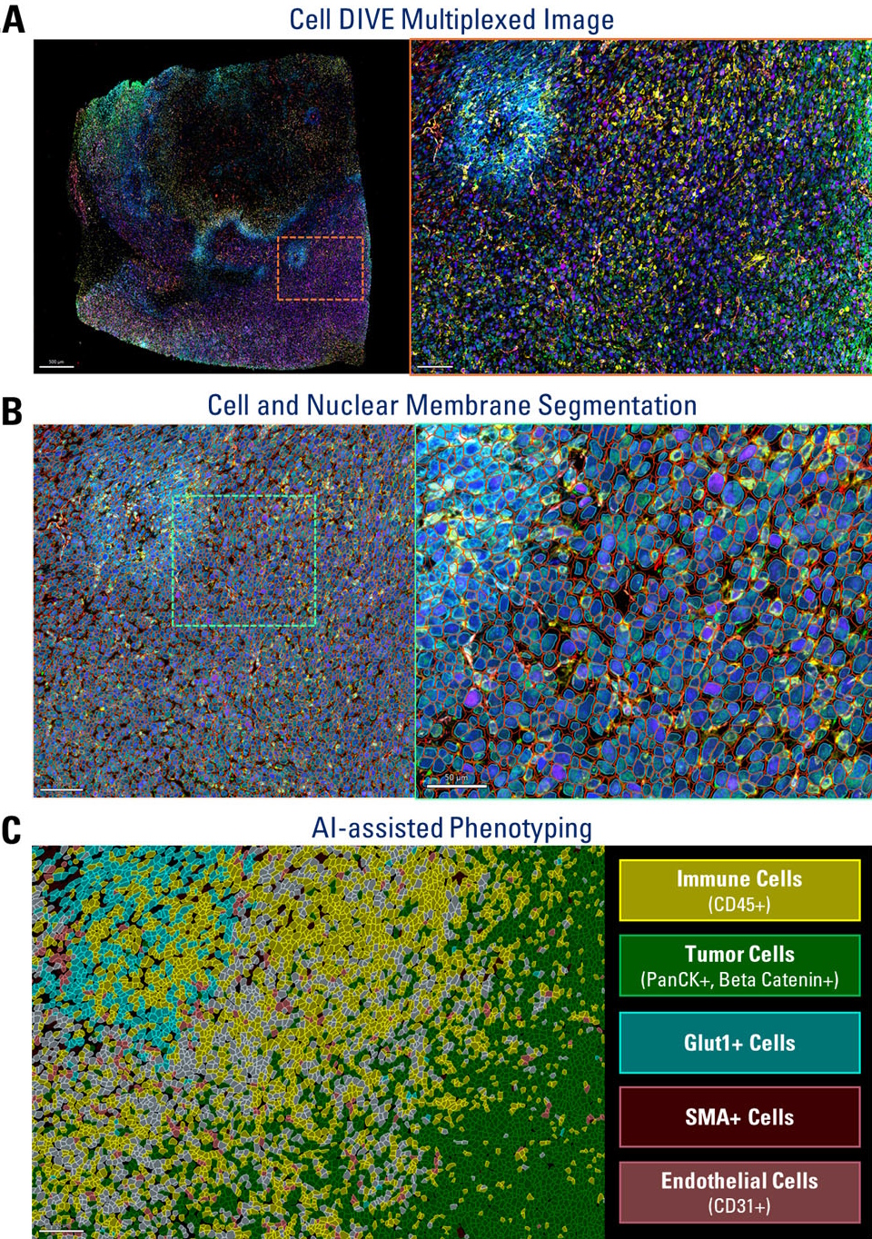 Mapping Tumor Immune Landscape with AI-Powered Spatial Proteomics ...