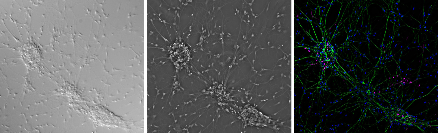 Introduction to Widefield Microscopy | Learn & Share | Leica Microsystems