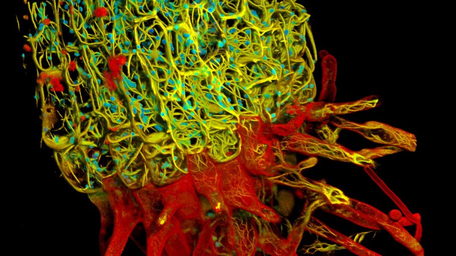 Confocal reimagined - STELLARIS - EMEA | Leica Microsystems