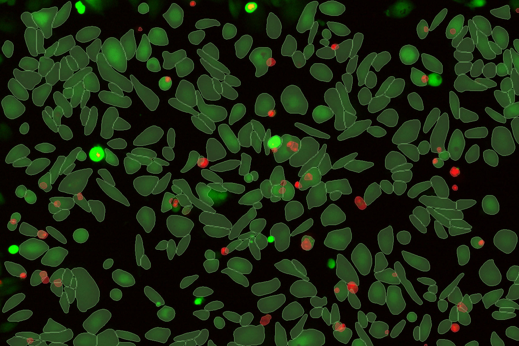 Aivia AI Image Analysis Software | Products | Leica Microsystems