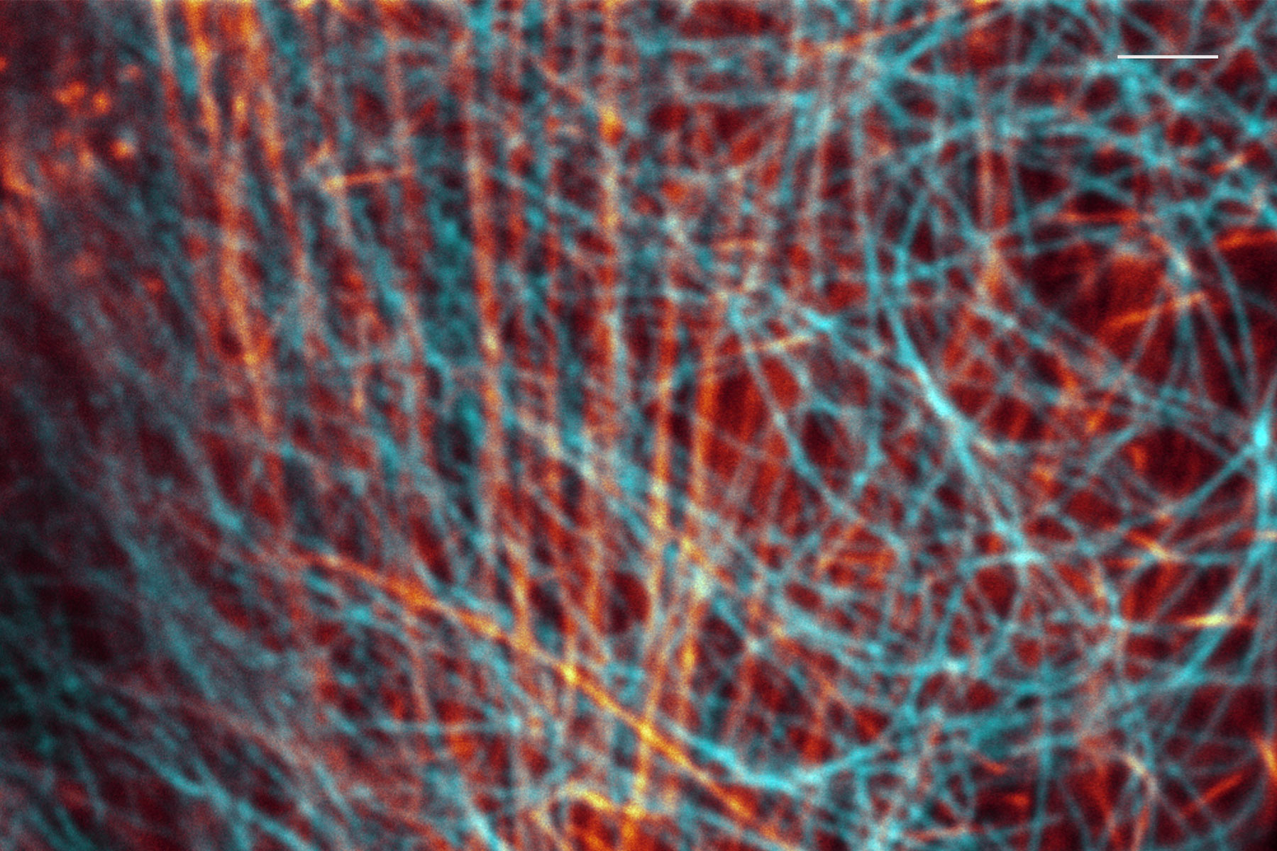 STELLARIS STED Stimulated Emission Depletion Microscope | Products ...