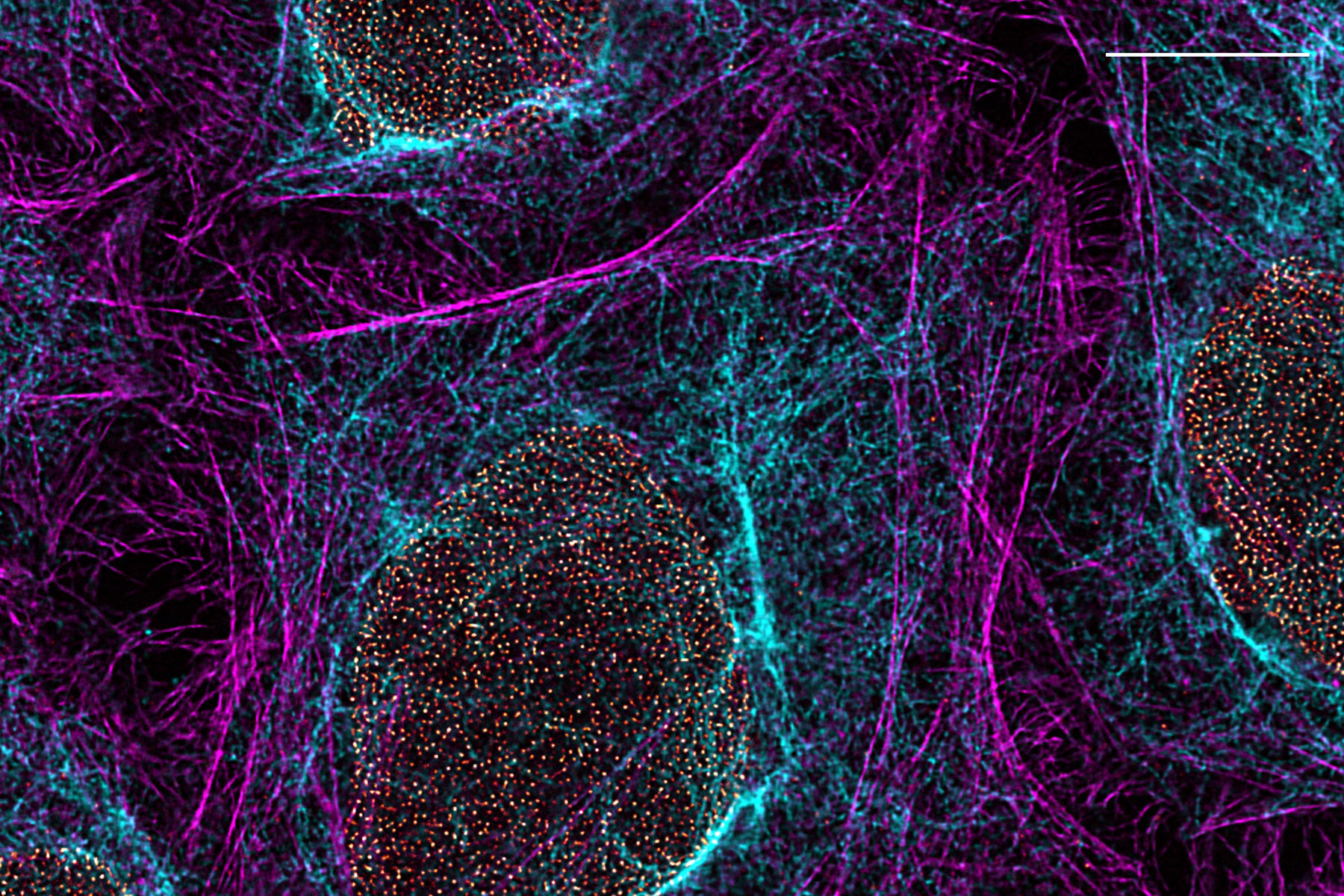 STELLARIS STED Stimulated Emission Depletion Microscope | Products ...