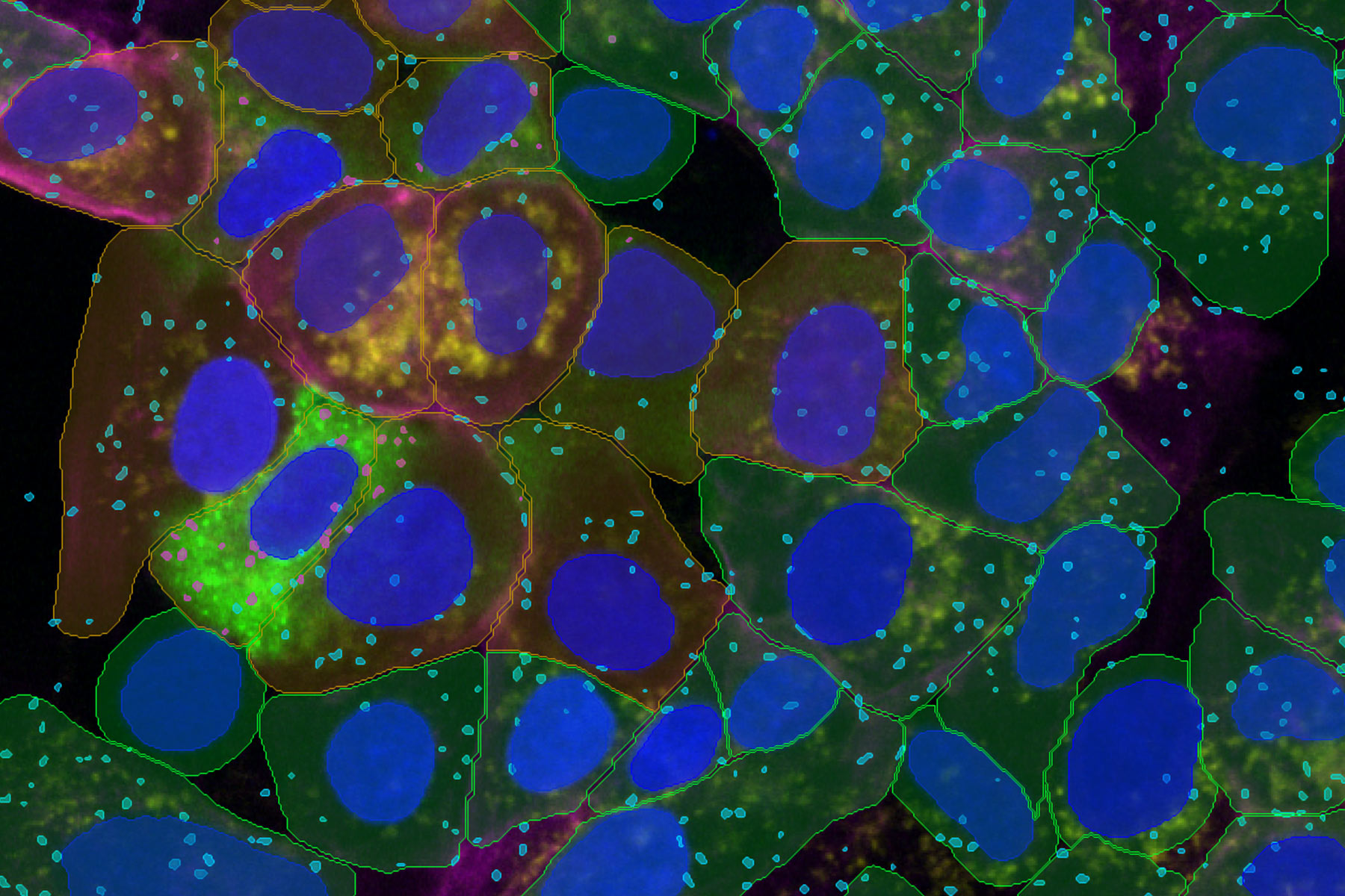 Aivia AI Image Analysis Software | Products | Leica Microsystems